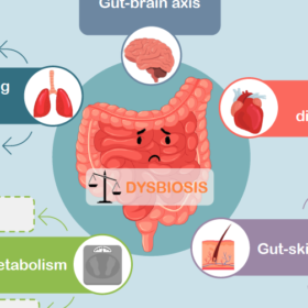 INFOGRAPHIC - Consequences of microbiota dysbiosis on health - Exden